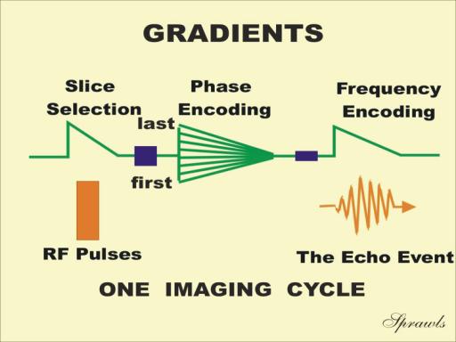 Magnetic Resonance Imaging